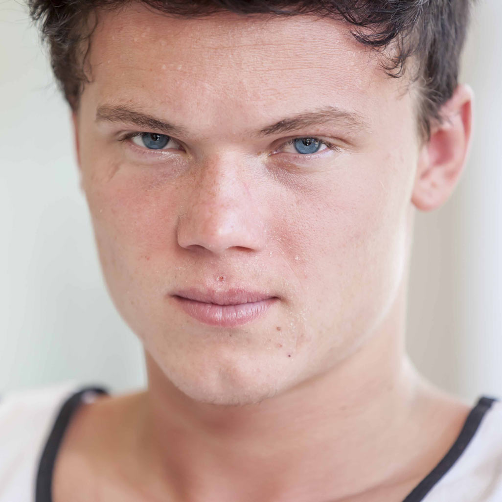 BrightOcular change eye color permanently, eye color surgery